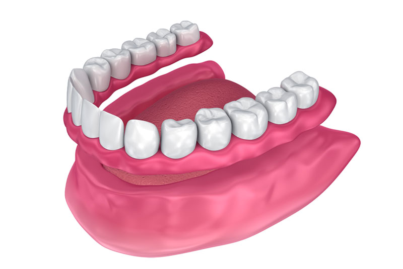 Full & Partial Dentures | Worthington, OH | Spectrum Dental and ...
